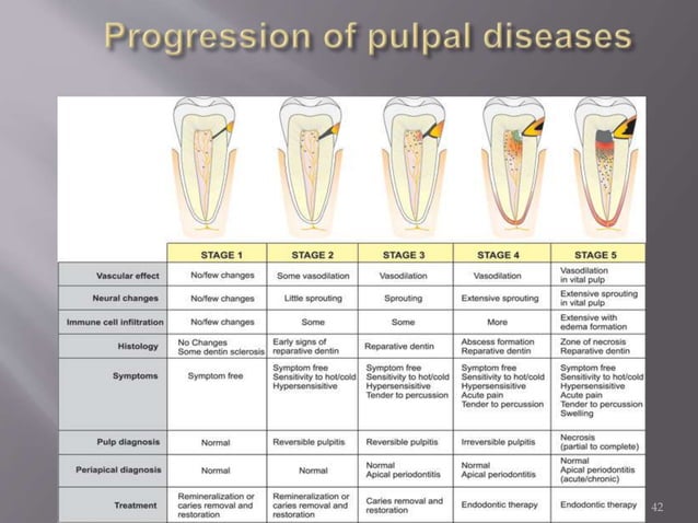 Diseases for pulp and periapical tissues | PPTX