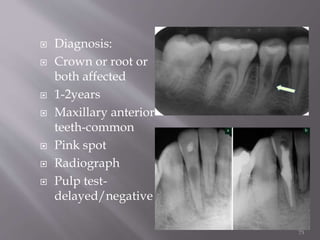 Diseases for pulp and periapical tissues | PPTX