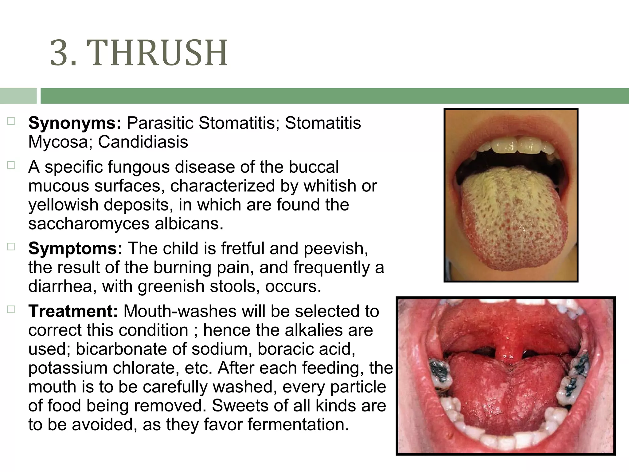 DISEASES IN THE DIGESTIVE SYSTEM - Student Nurses | PPT