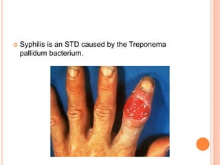 Diseases in the reproductive system | PPTX