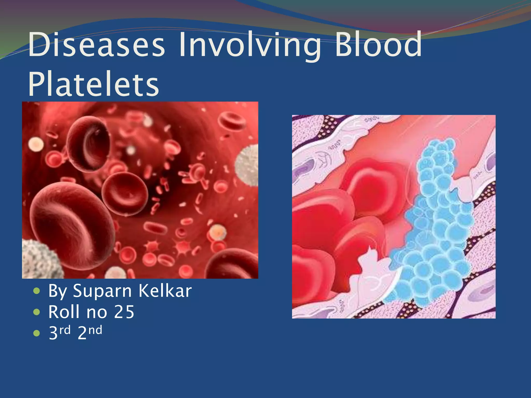 Diseases involving blood platelets | PPT