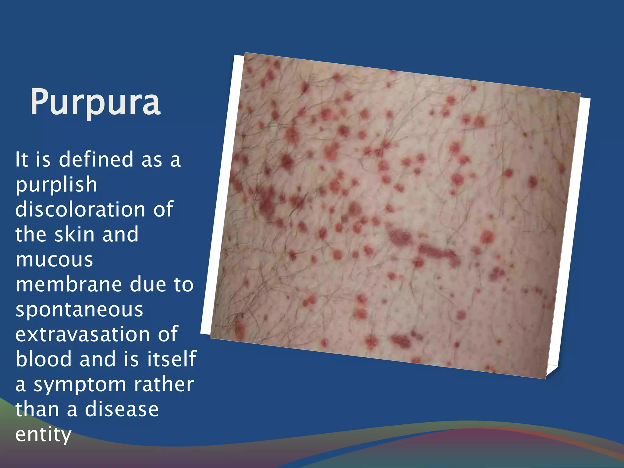 Diseases involving blood platelets | PPTX