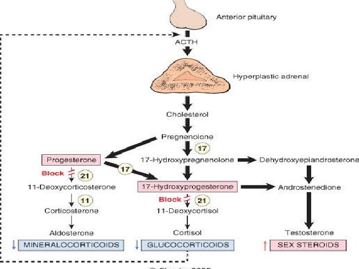 Congenital Adrenal Hyperplasia Etiology Pathophysiology Clinical