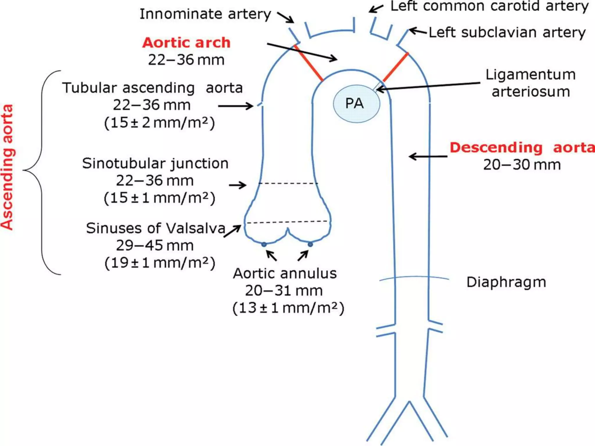 Diseases of aorta | PPTX