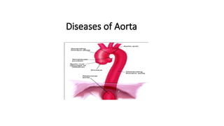 Diseases of Aorta Echocardiography assessment .pptx