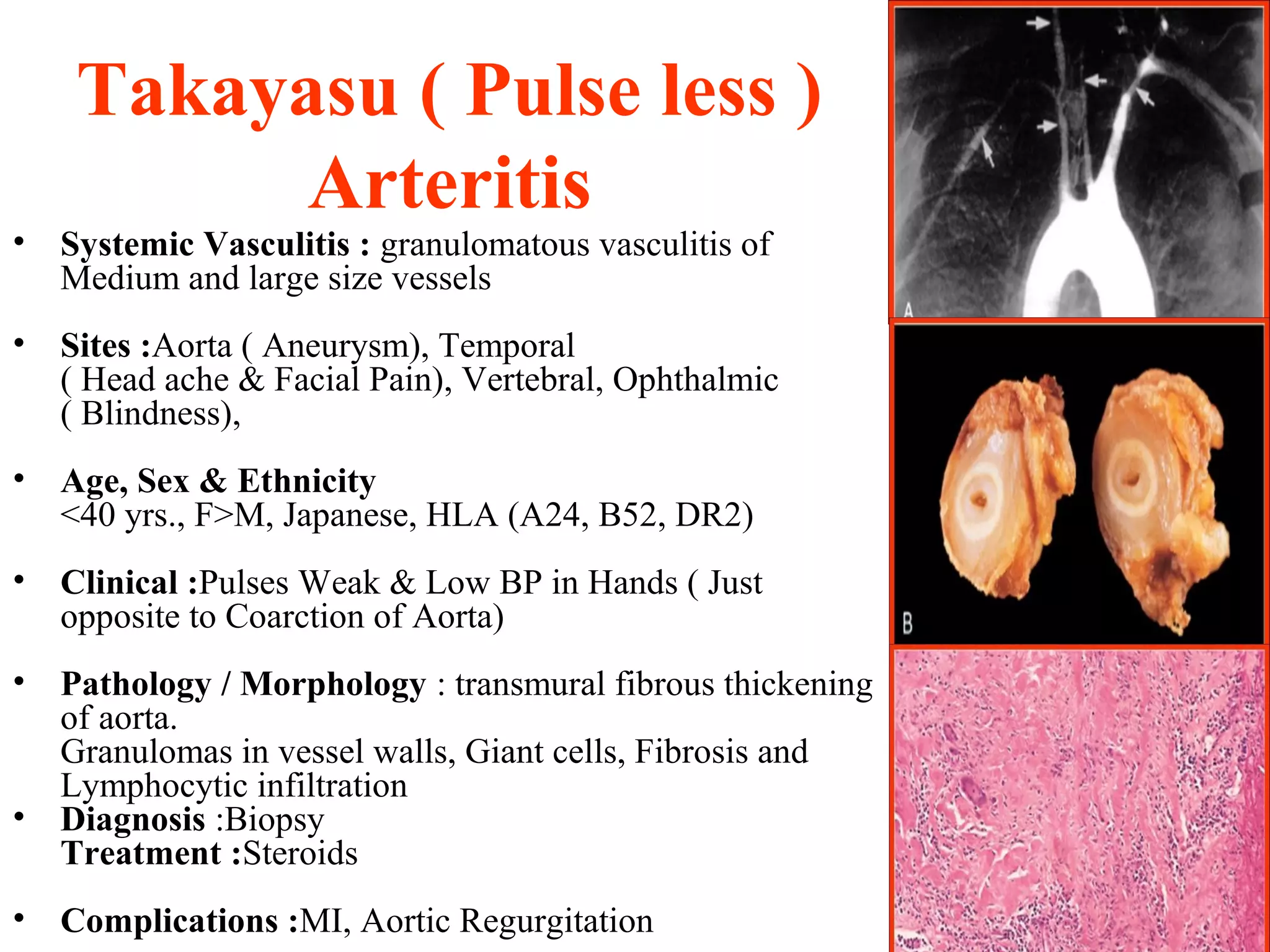 Diseases of blood vessels | PPT