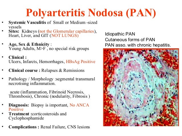 Diseases of blood vessels