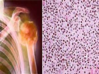 DISEASES OF BONE FOR HOMOEOPATHIC STUDIENTS | PPTX
