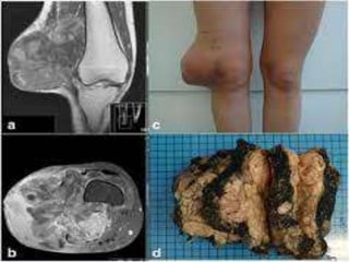 DISEASES OF BONE FOR HOMOEOPATHIC STUDIENTS | PPTX