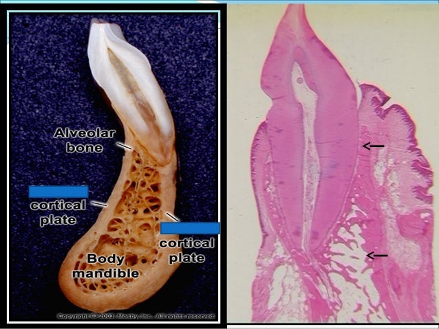 Diseases of bone and its oral aspects