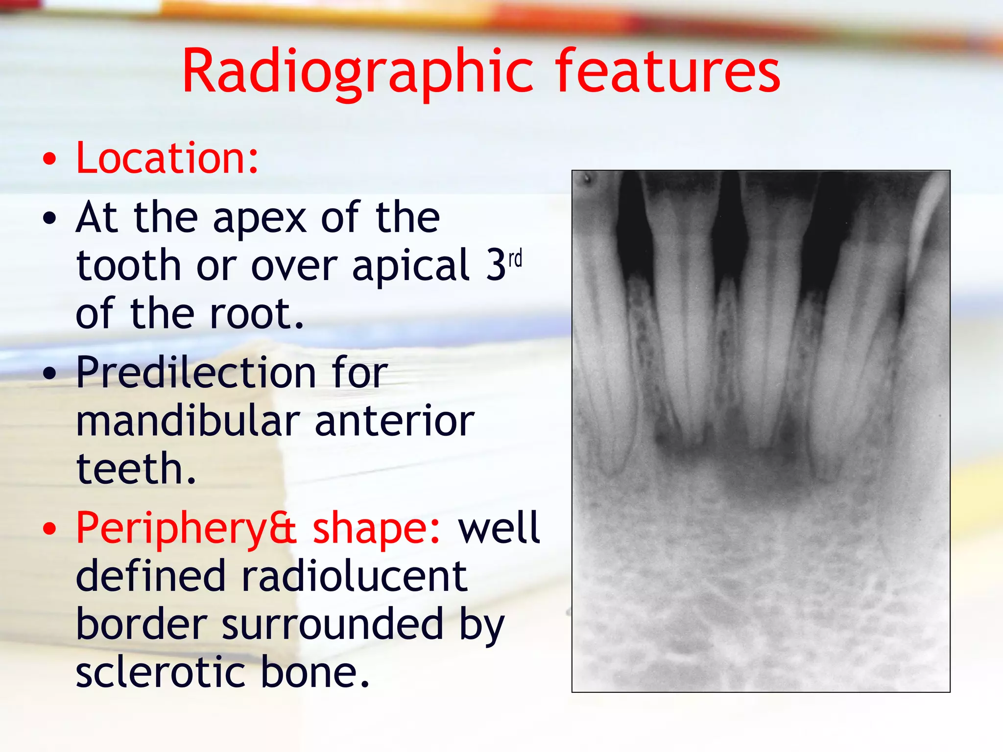 Diseases of bone manifested in the jaws | PPT