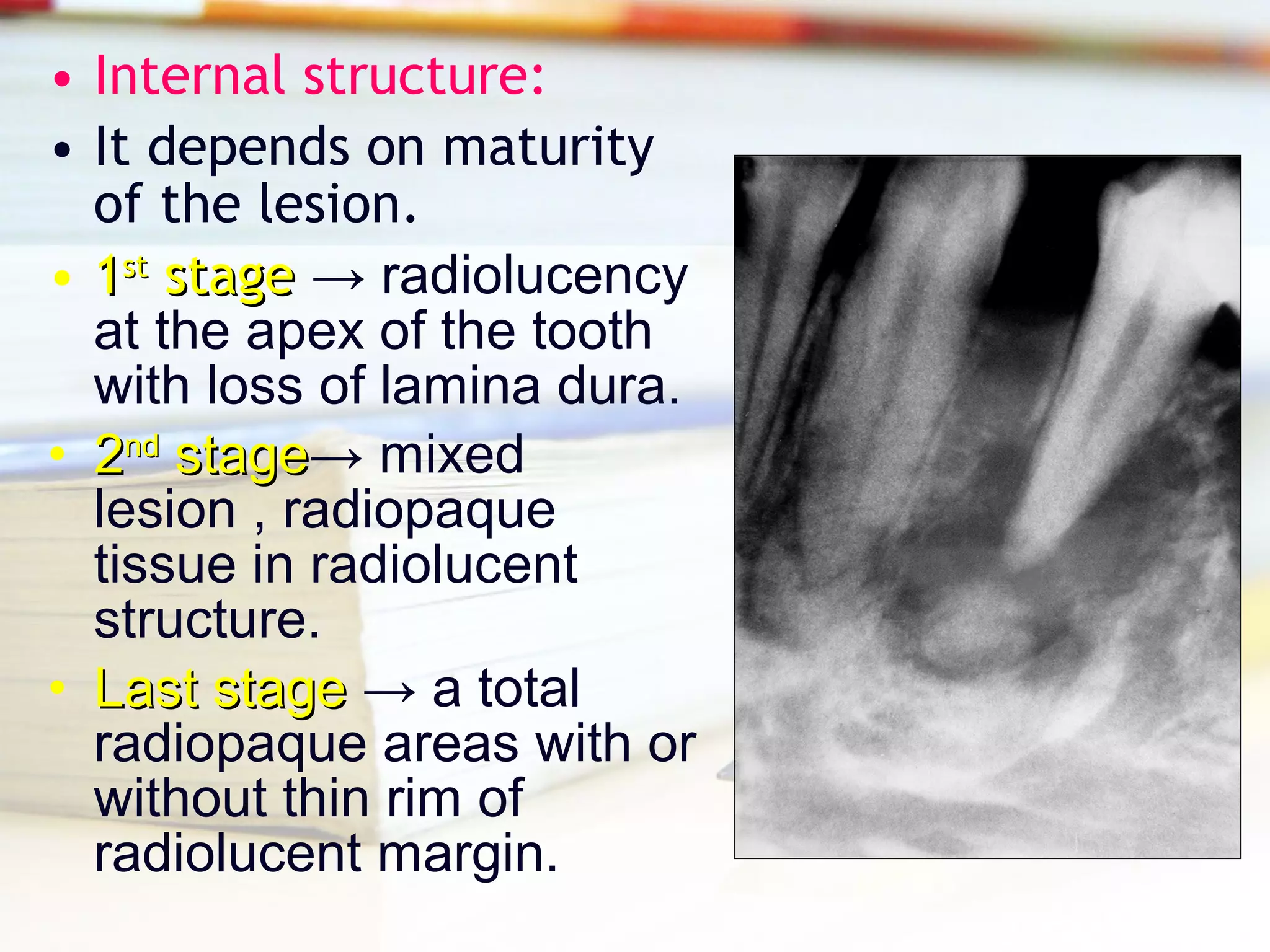 Diseases of bone manifested in the jaws | PPT