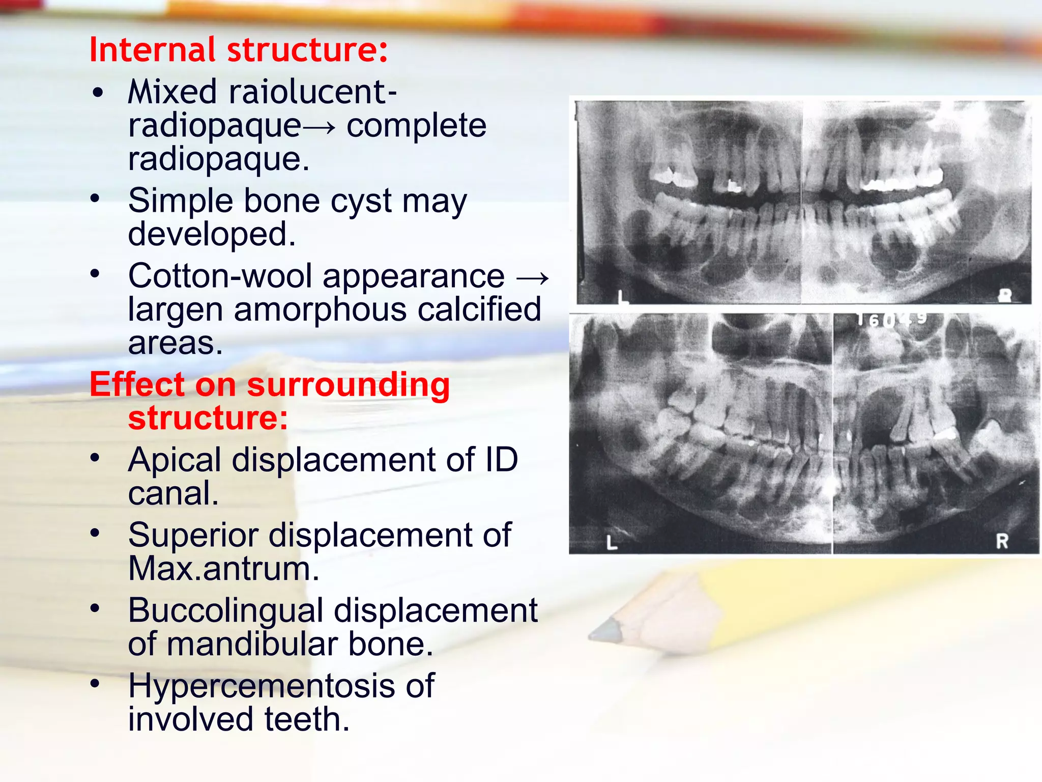 Diseases of bone manifested in the jaws | PPT