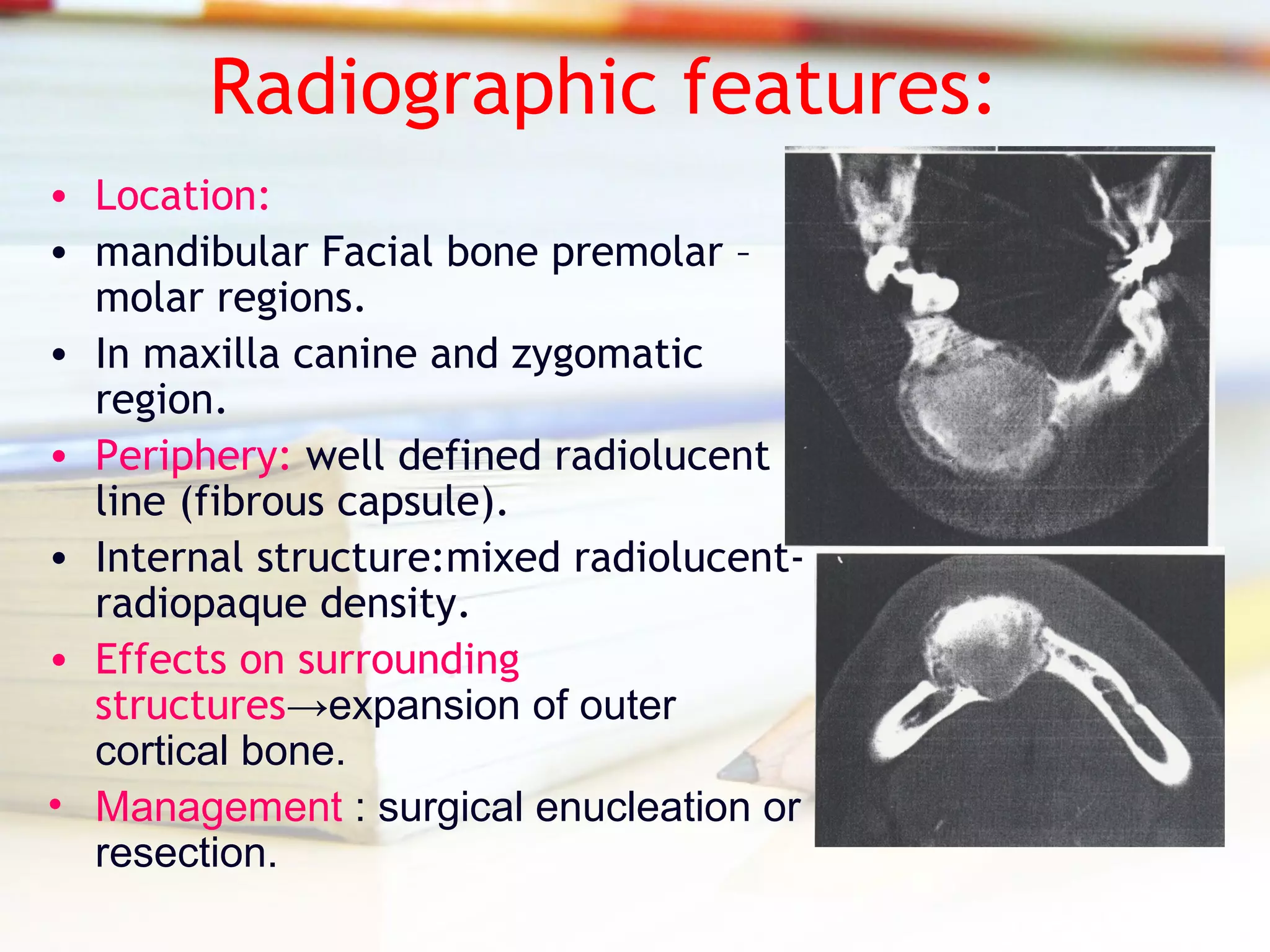 Diseases of bone manifested in the jaws | PPT