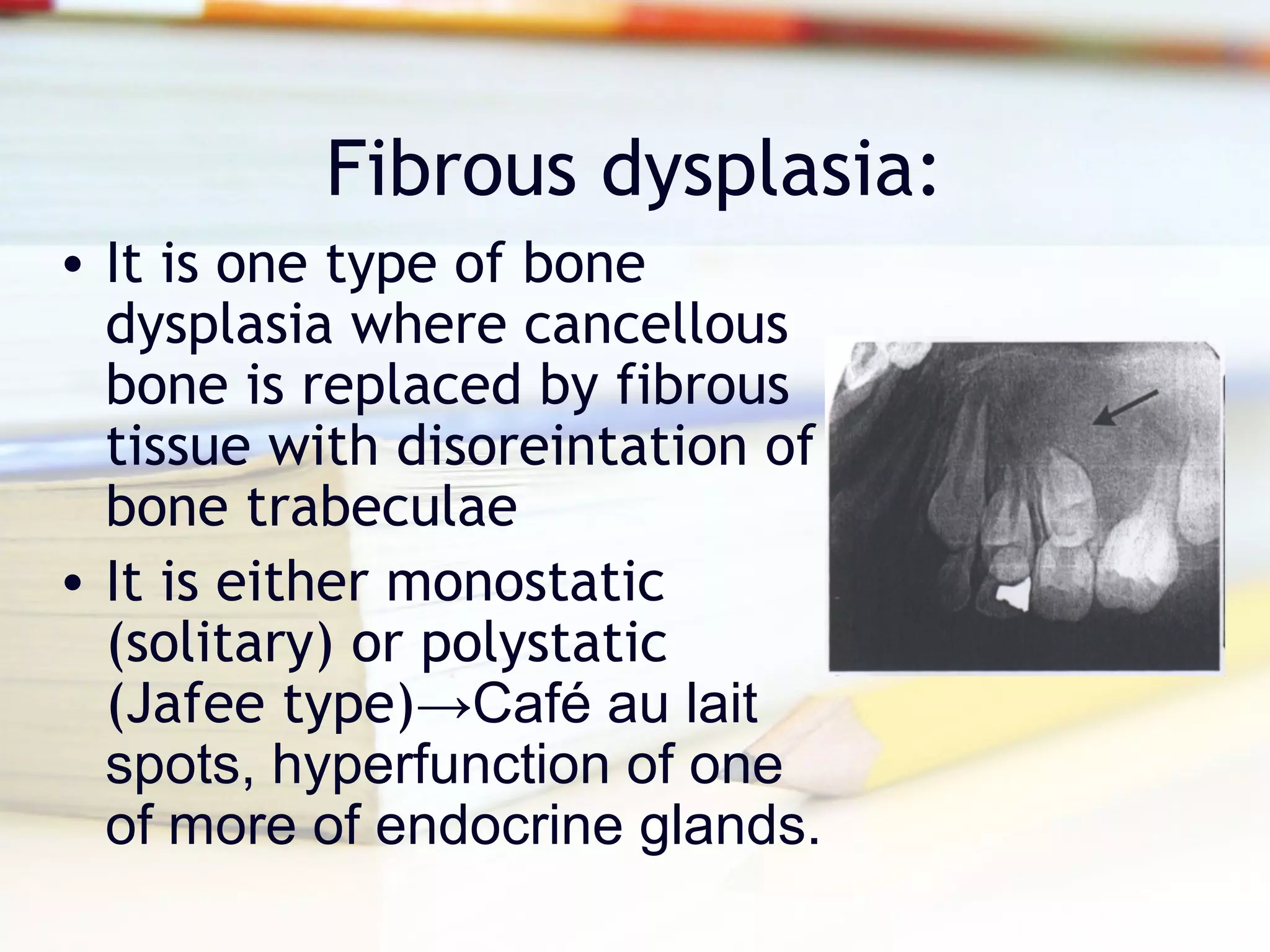 Diseases of bone manifested in the jaws | PPT