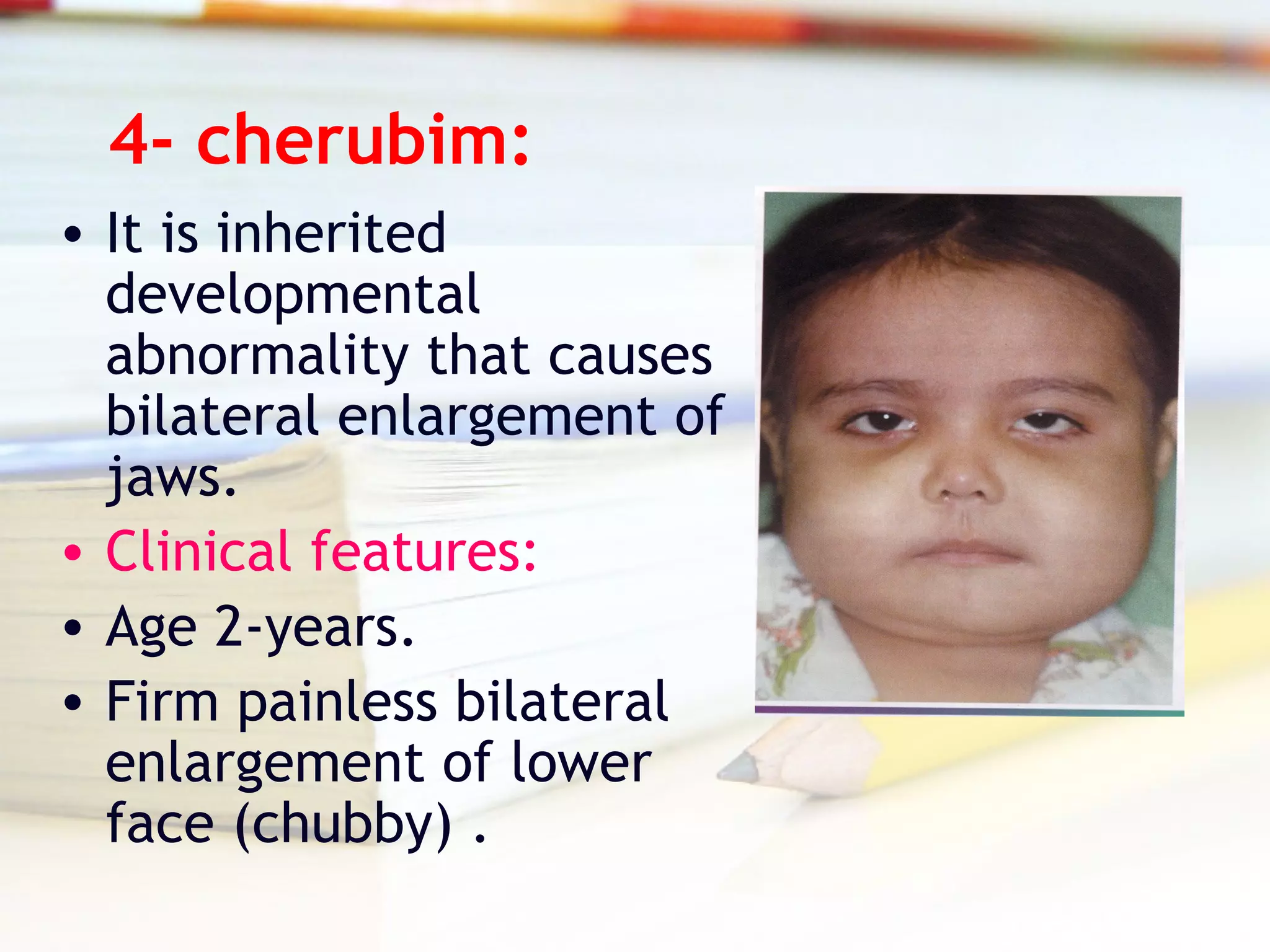 Diseases of bone manifested in the jaws | PPT