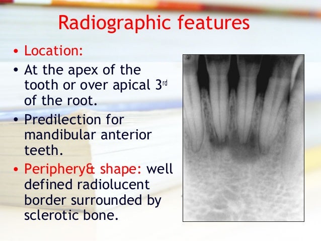 Diseases of bone manifested in the jaws