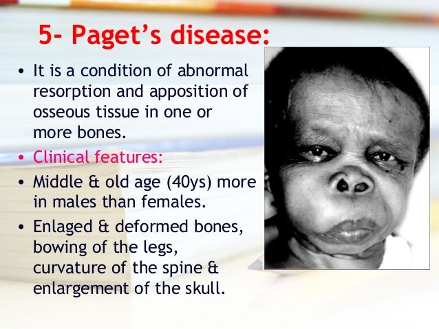 Diseases of bone manifested in the jaws