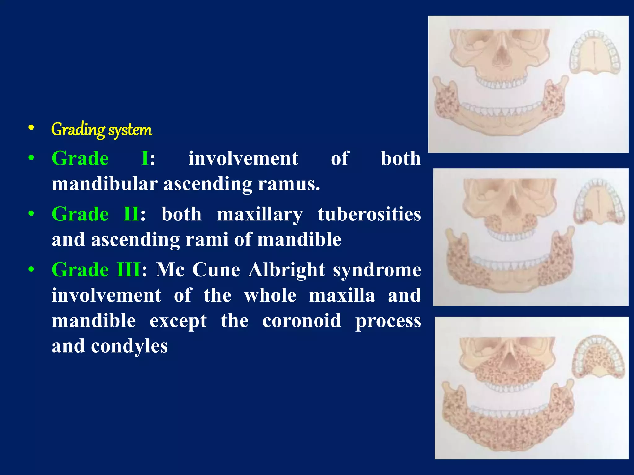Diseases of bones and joint | PPTX