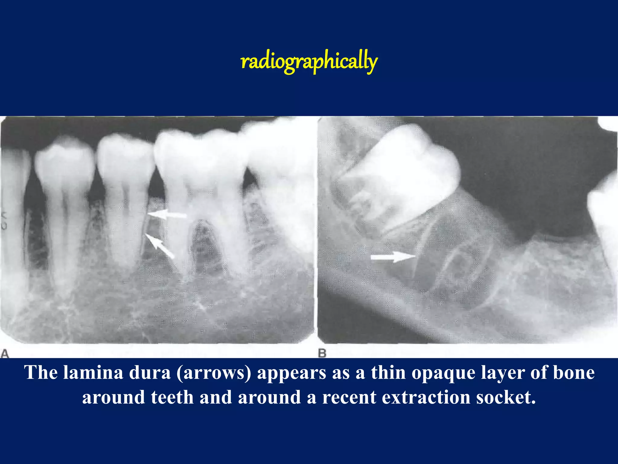 Diseases of bones and joint | PPTX
