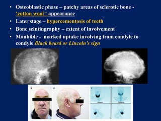 Diseases of bones and joint | PPTX