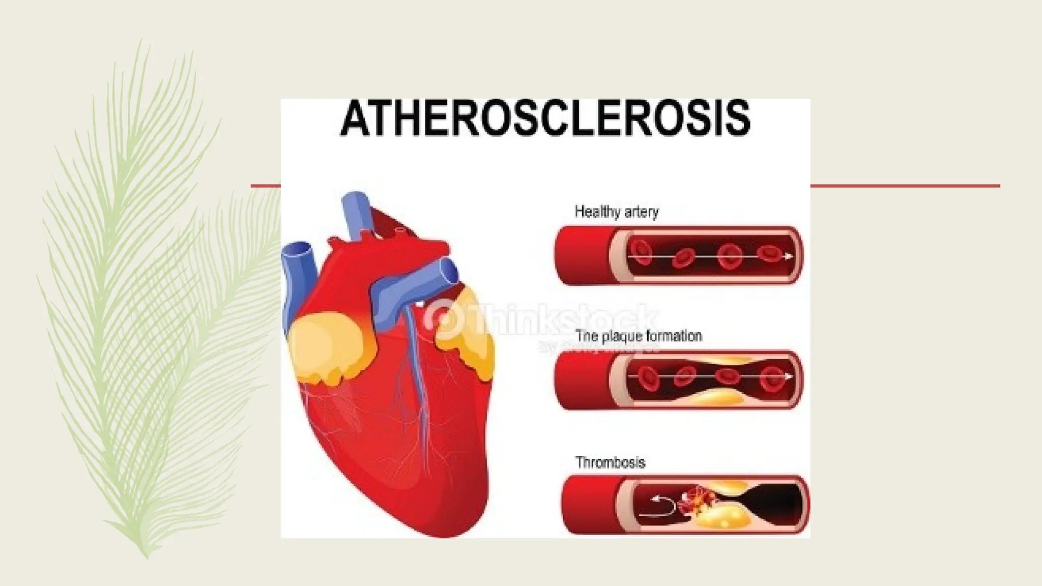 Diseases of Circulatory System and treatment.pptx