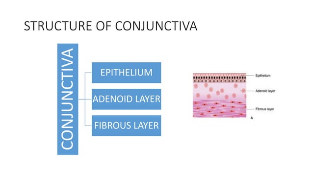 Diseases of conjunctiva ppt ophthalmology | PPTX | Eye and Vision ...