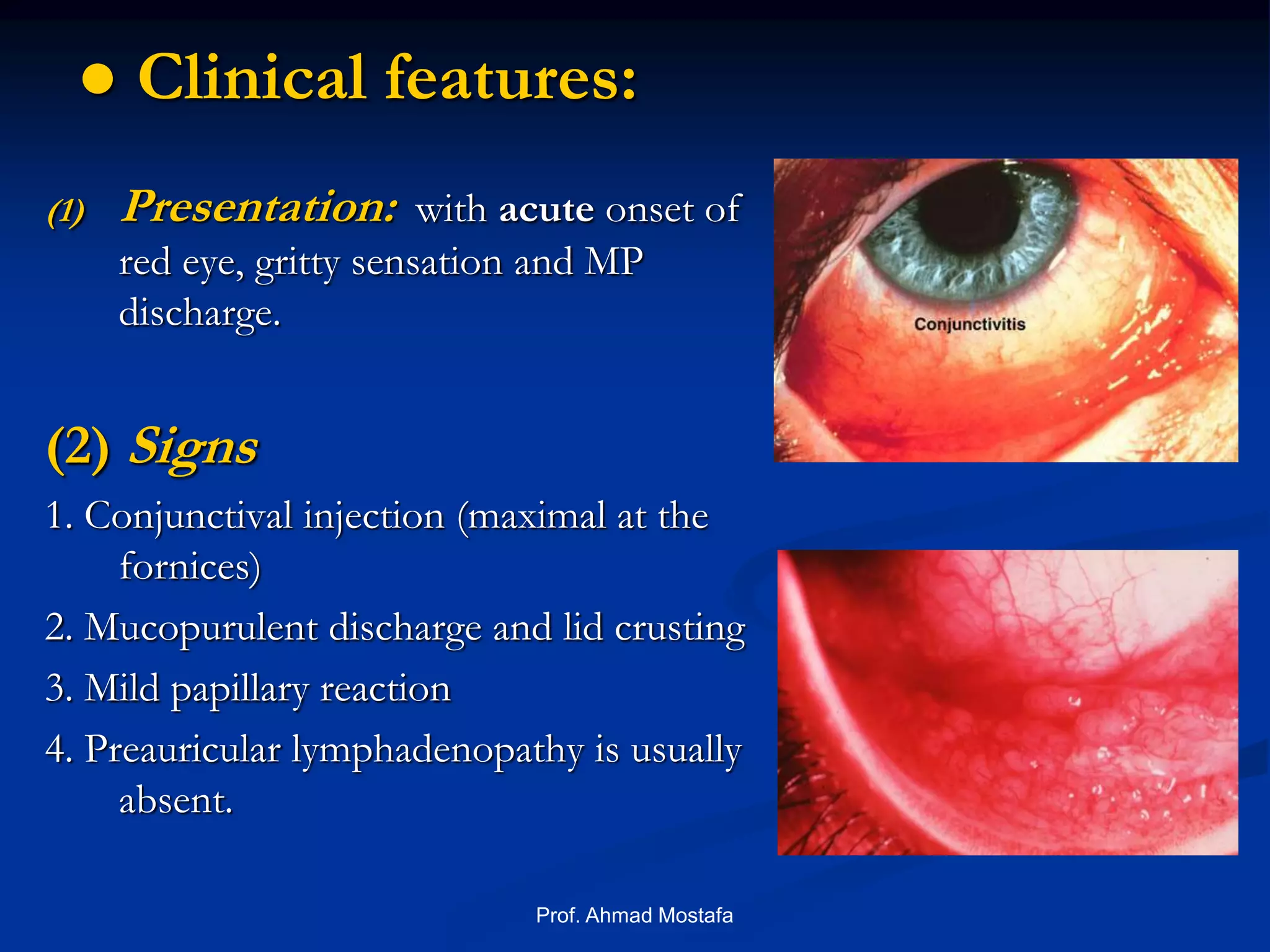 Diseases of conjunctiva | PPT
