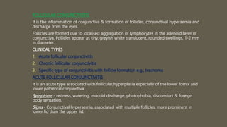 DISEASES OF CONJUNCTIVA.pptx