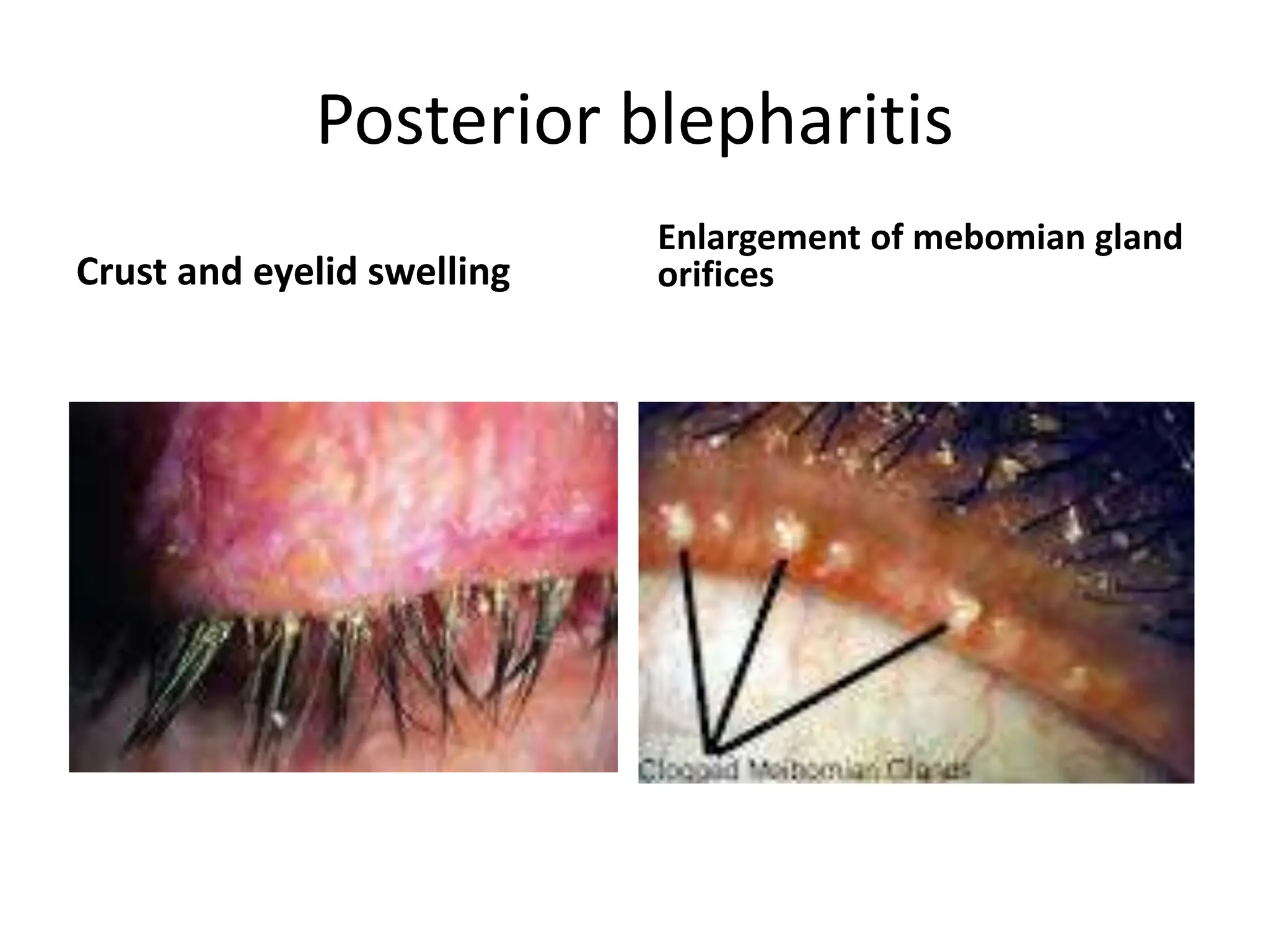 Diseases of Conjunctiva.pptx