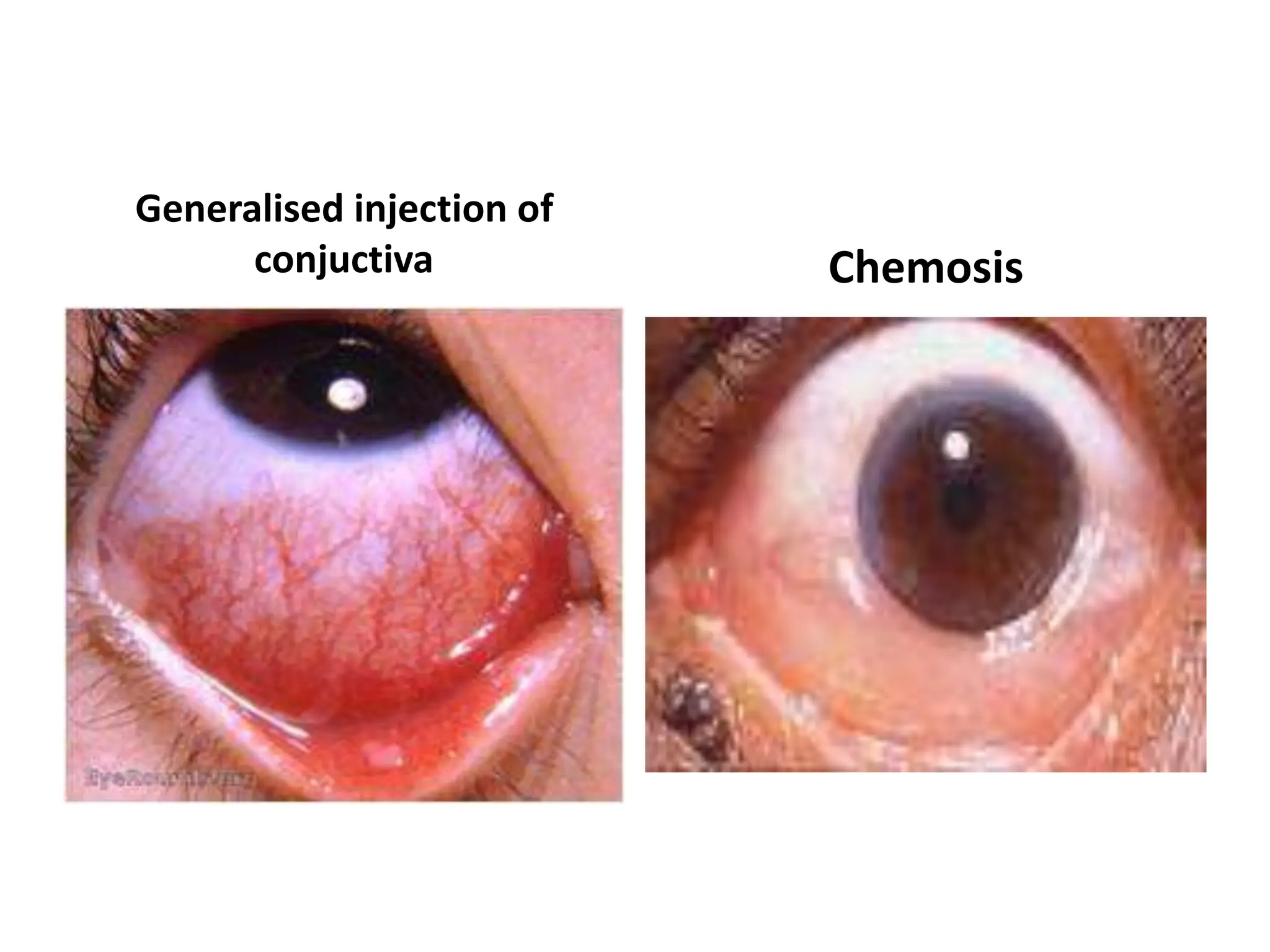 Diseases of Conjunctiva.pptx