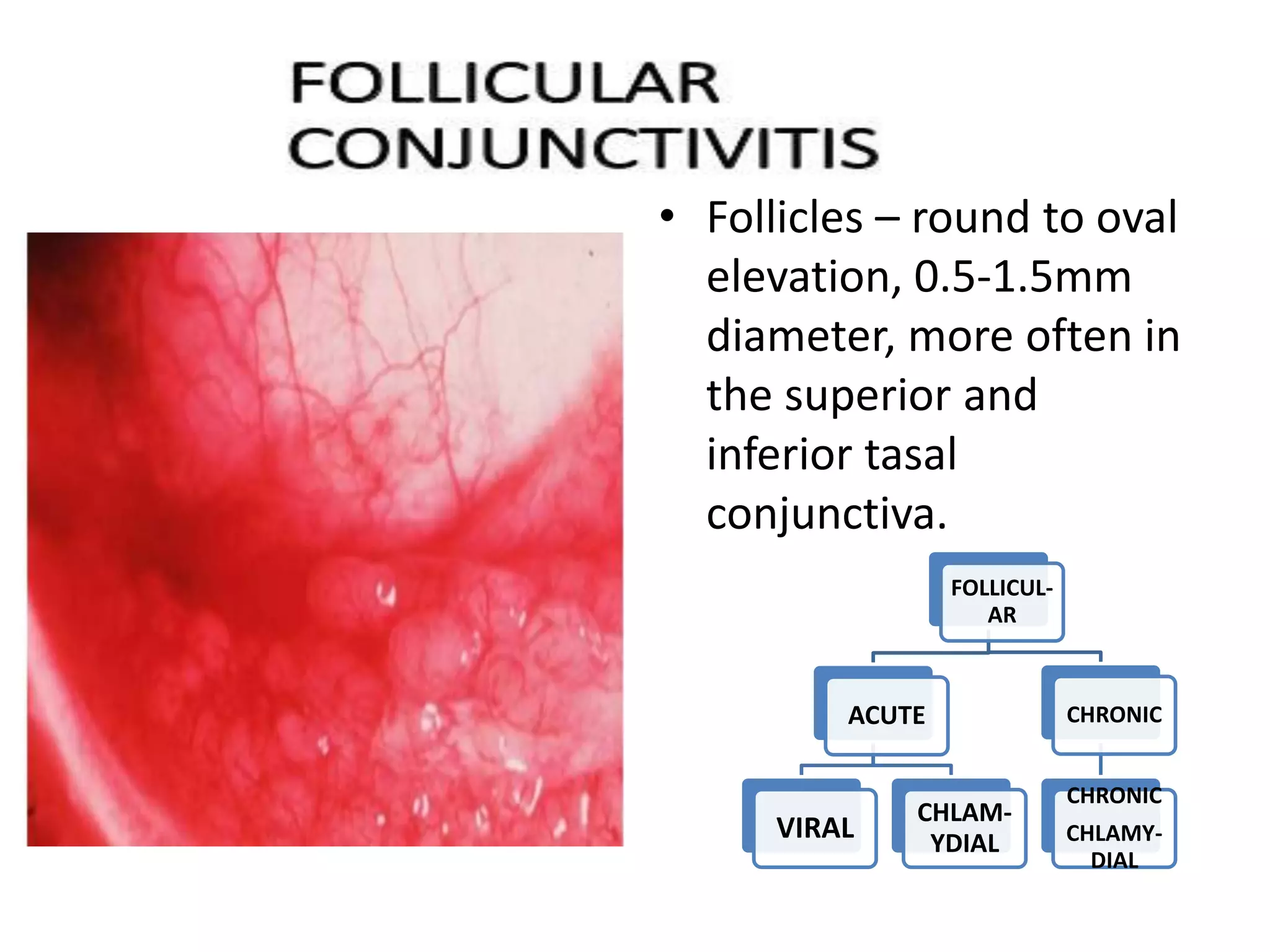 DISEASES OF CONJUNCTIVA---.pptx