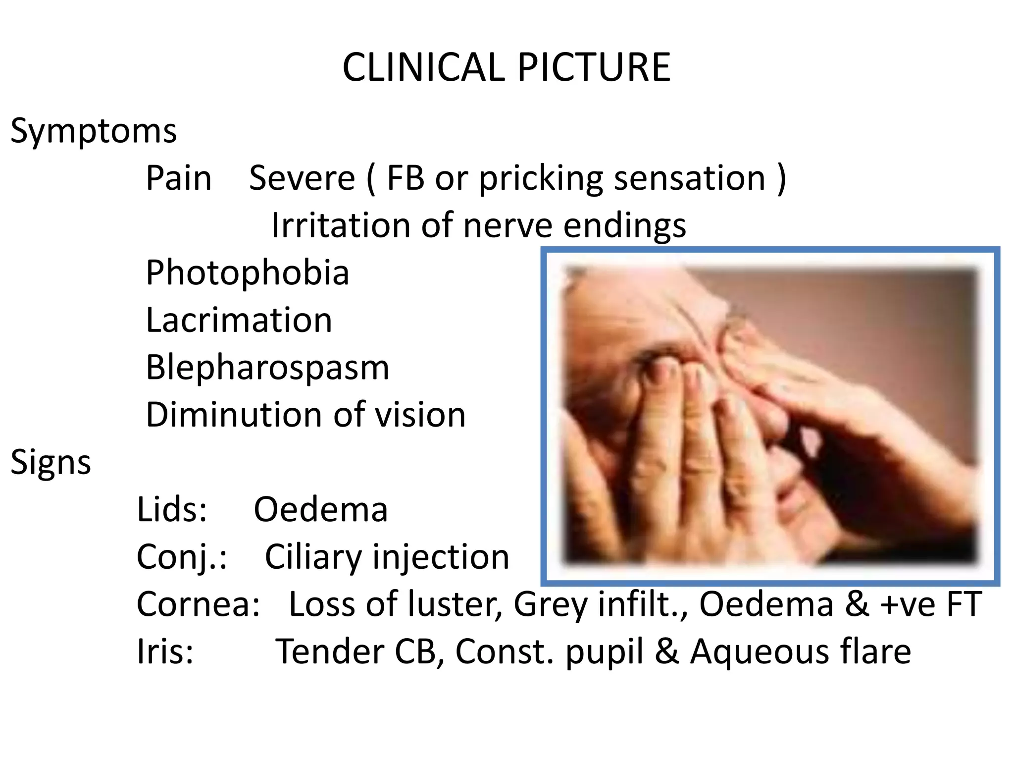 DISEASES OF CORNEA---5.pptx