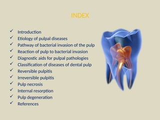 Diseases of Dental Pulp for dental students.pptx