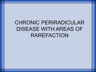 DISEASES OF DENTAL PULP AND PERI RADICULAR TISSUES.ppt