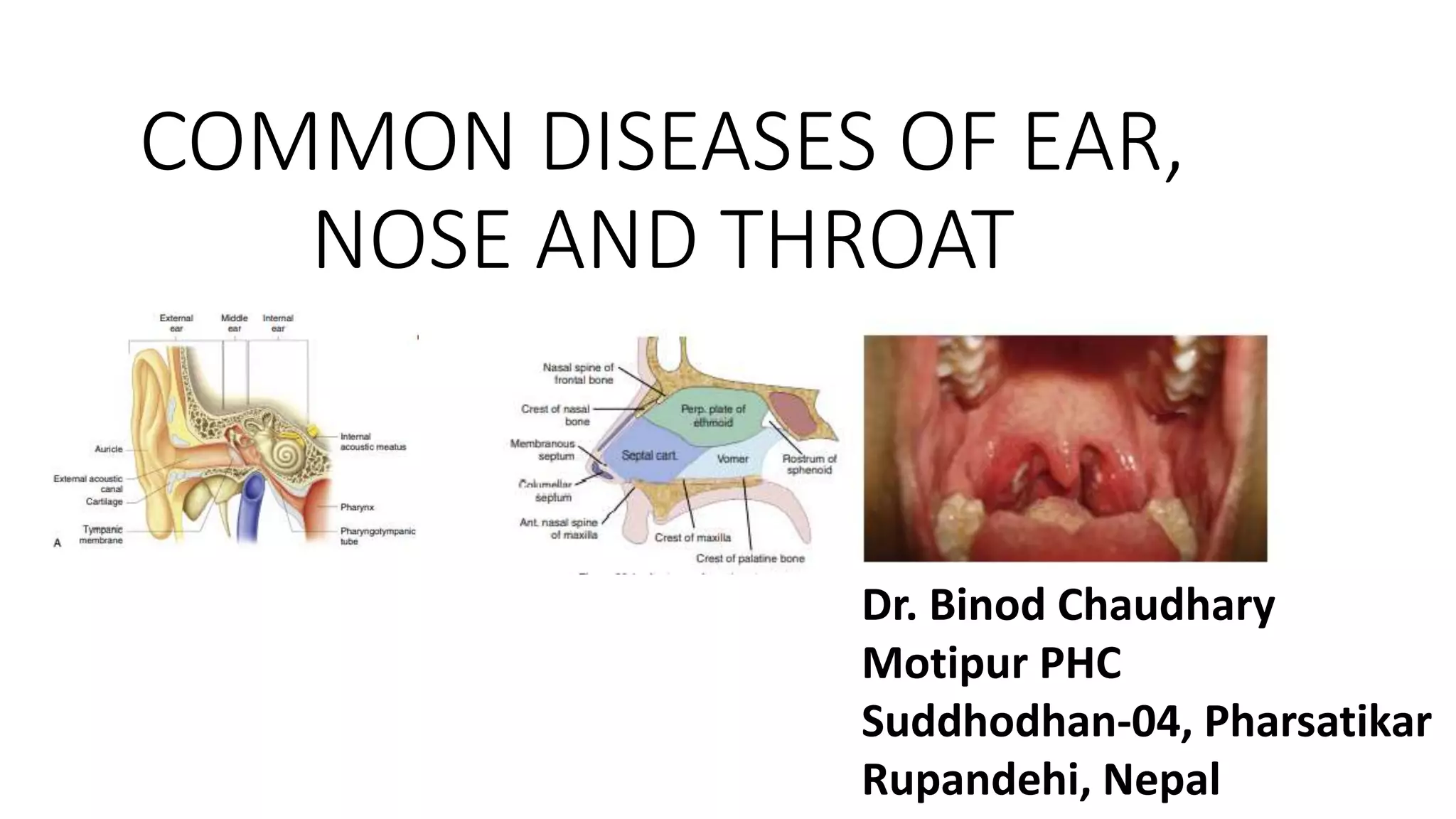 Diseases of ear, nose and throat | PPTX