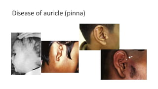 Diseases of ear, nose and throat | PPTX