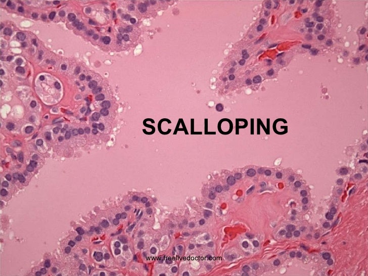 Diseases of endocrinal glands