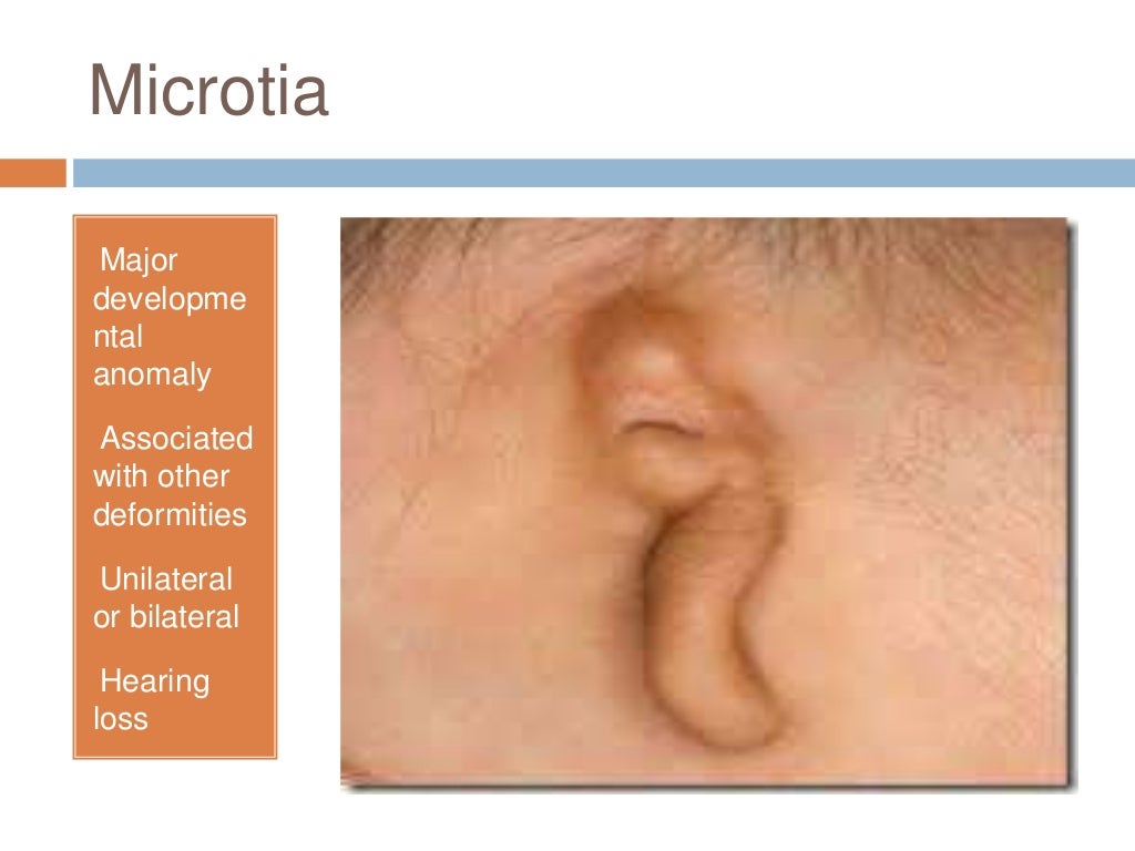 Diseases Of External Ear