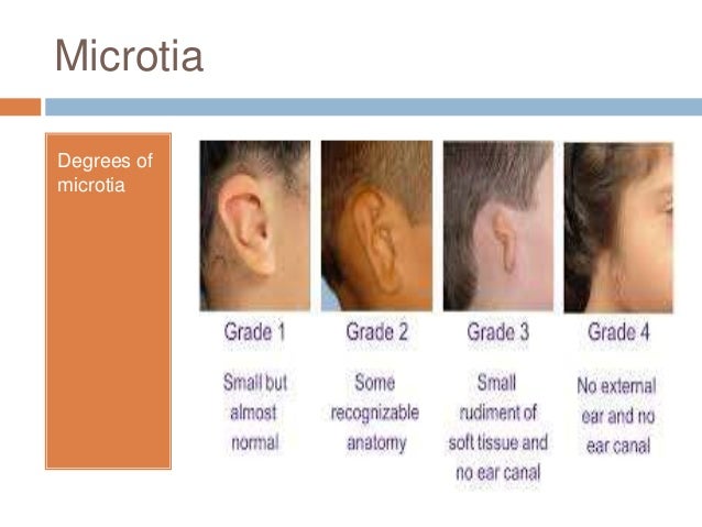 Diseases of external ear