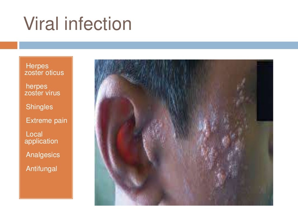 Diseases Of External Ear
