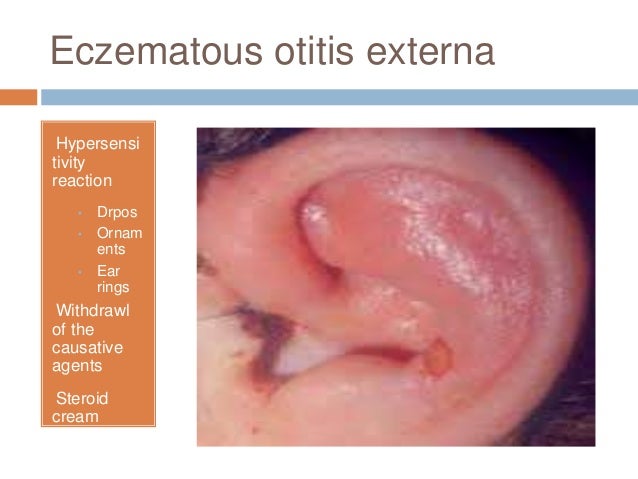 Diseases Of External Ear