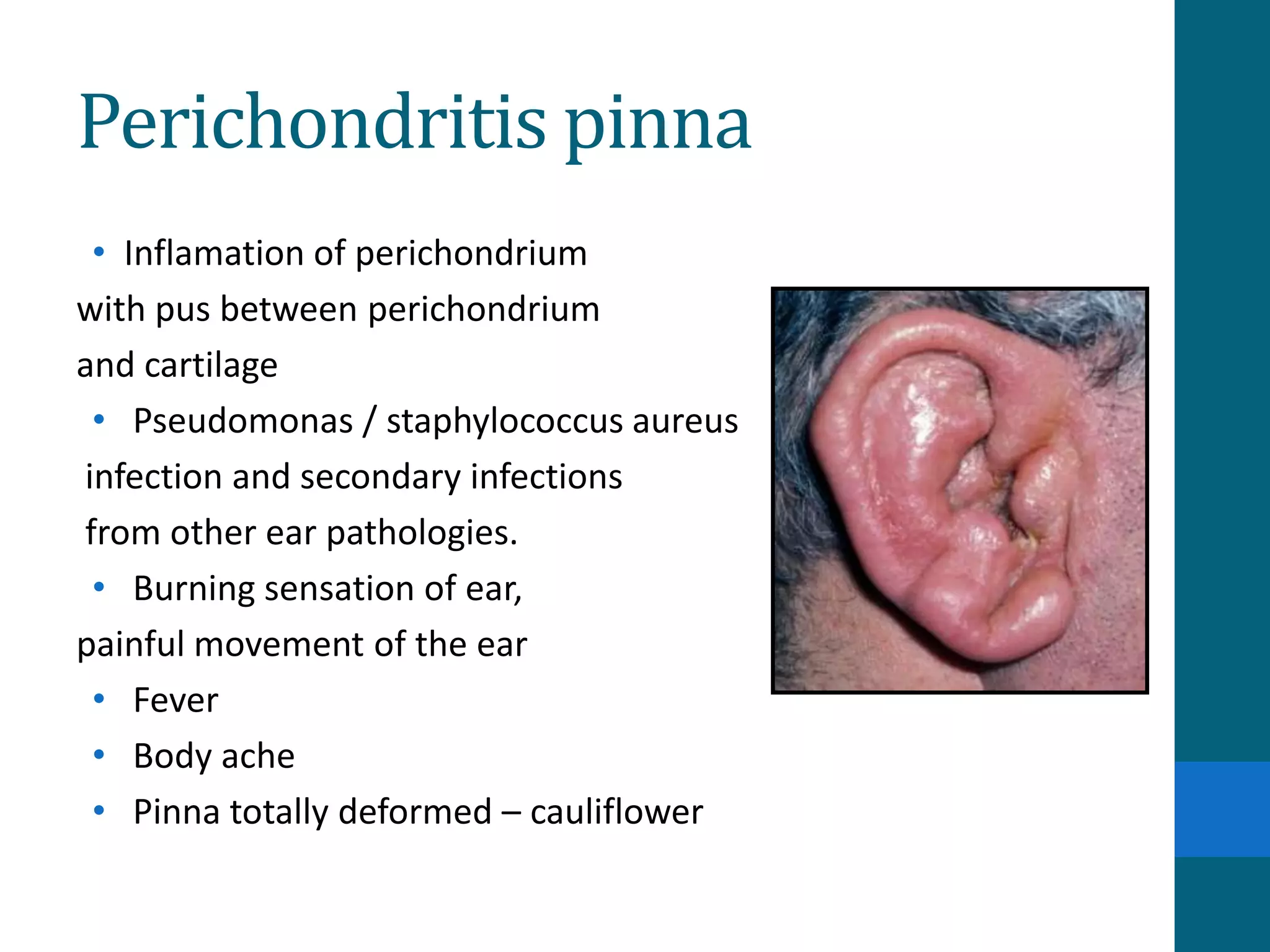Diseases of external ear | PPTX