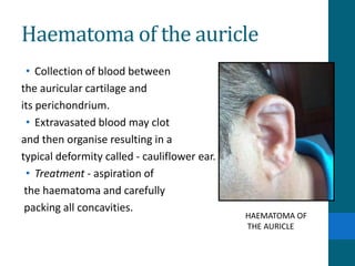 Diseases of external ear | PPTX