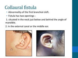 Diseases of external ear | PPT