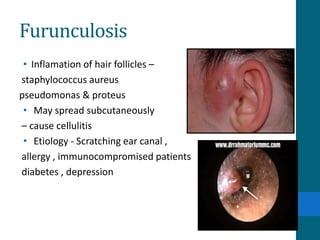 Auricular Cellulitis