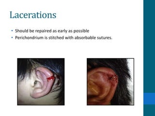Diseases of external ear | PPT