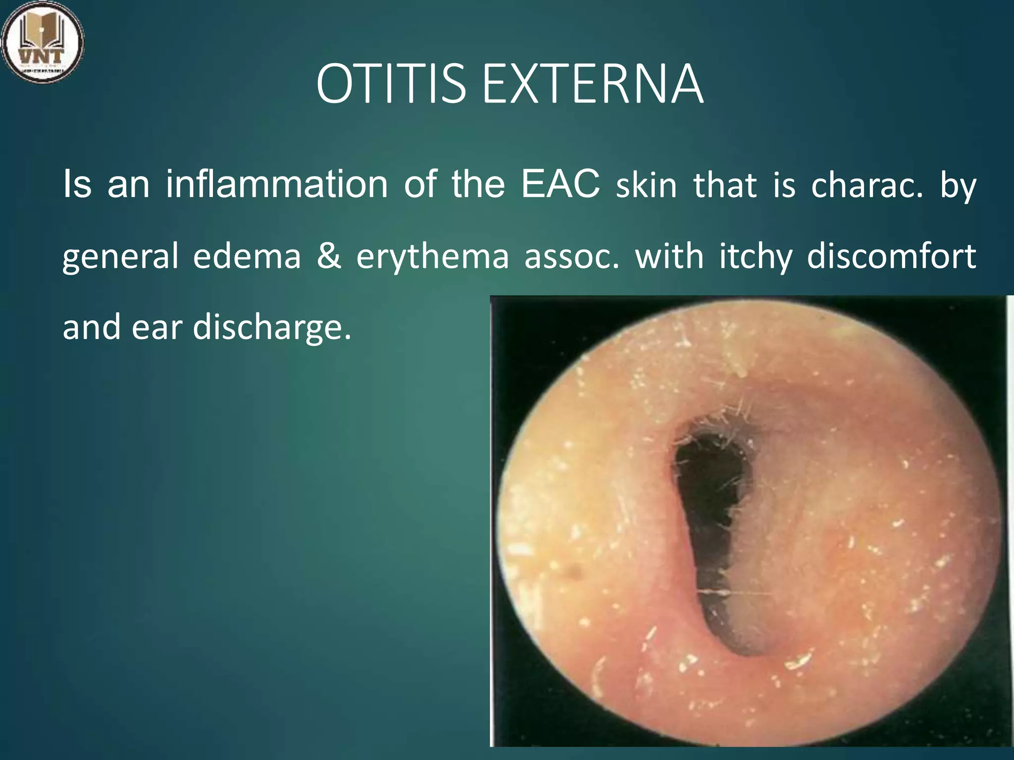 Diseases of external ear | PPTX