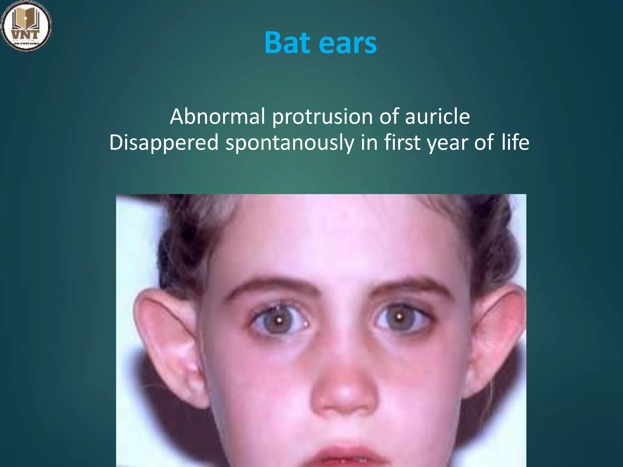 Diseases of external ear | PPTX