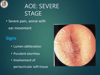Diseases of external ear | PPTX